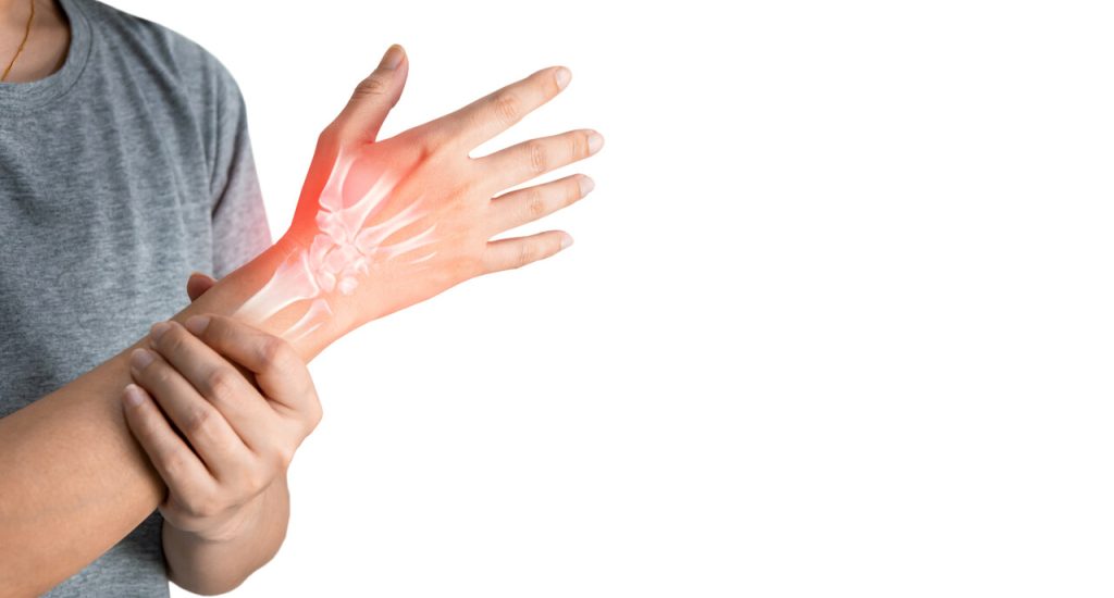Quais são os tipos mais comuns de nódulos e tumor na mão? - Clínica ...